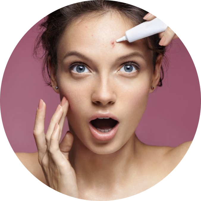 Acne Treatment - S125 CLINIC